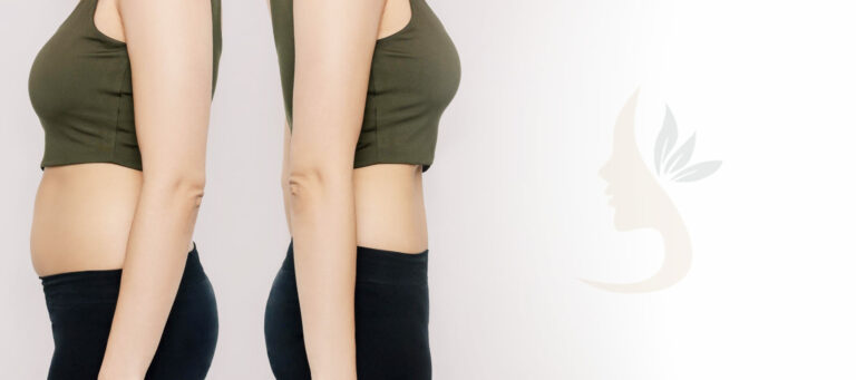 Top Liposuction Specialist Serving San Antonio Seguin TX