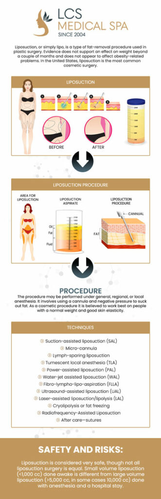 Liposuction Near Me Serving San Antonio, Seguin, TX